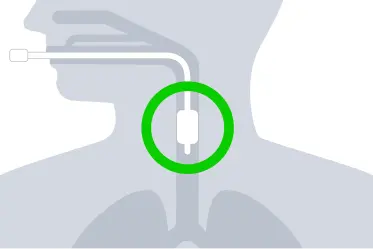 AG Cuffill cuff pressure manometer - Medline