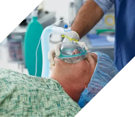 General anesthesia circuits and masks - Medline
