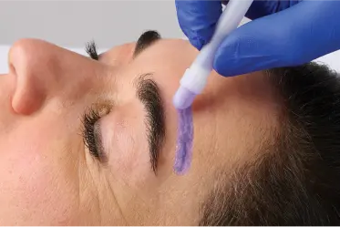 OptiClose topical skin adhesive products – Medline