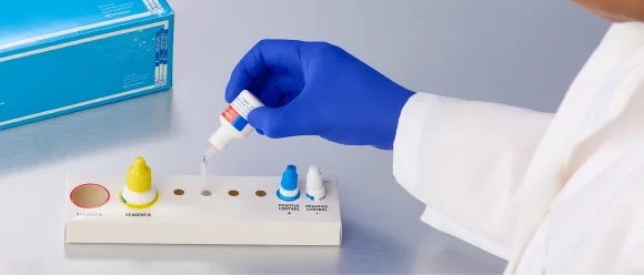 Point-of-care Testing Devices - Medline