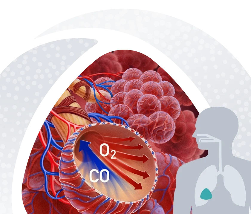 Oxygen management - Medline