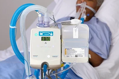 Ventilation management - Medline